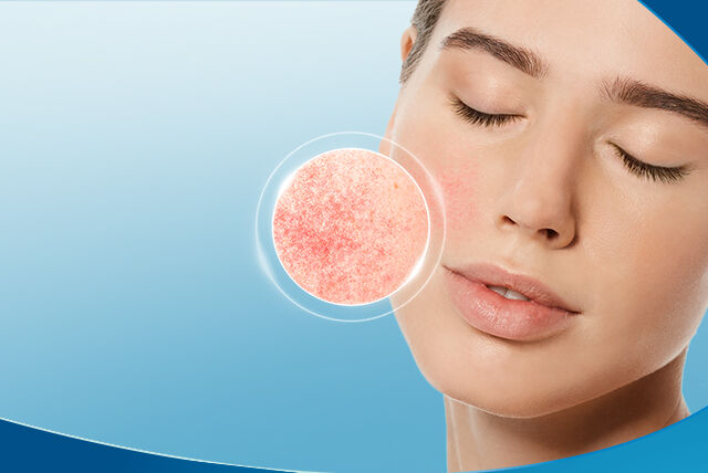 El mejor cuidado para las rojeces en la piel y en el rostro | Cetaphil ES